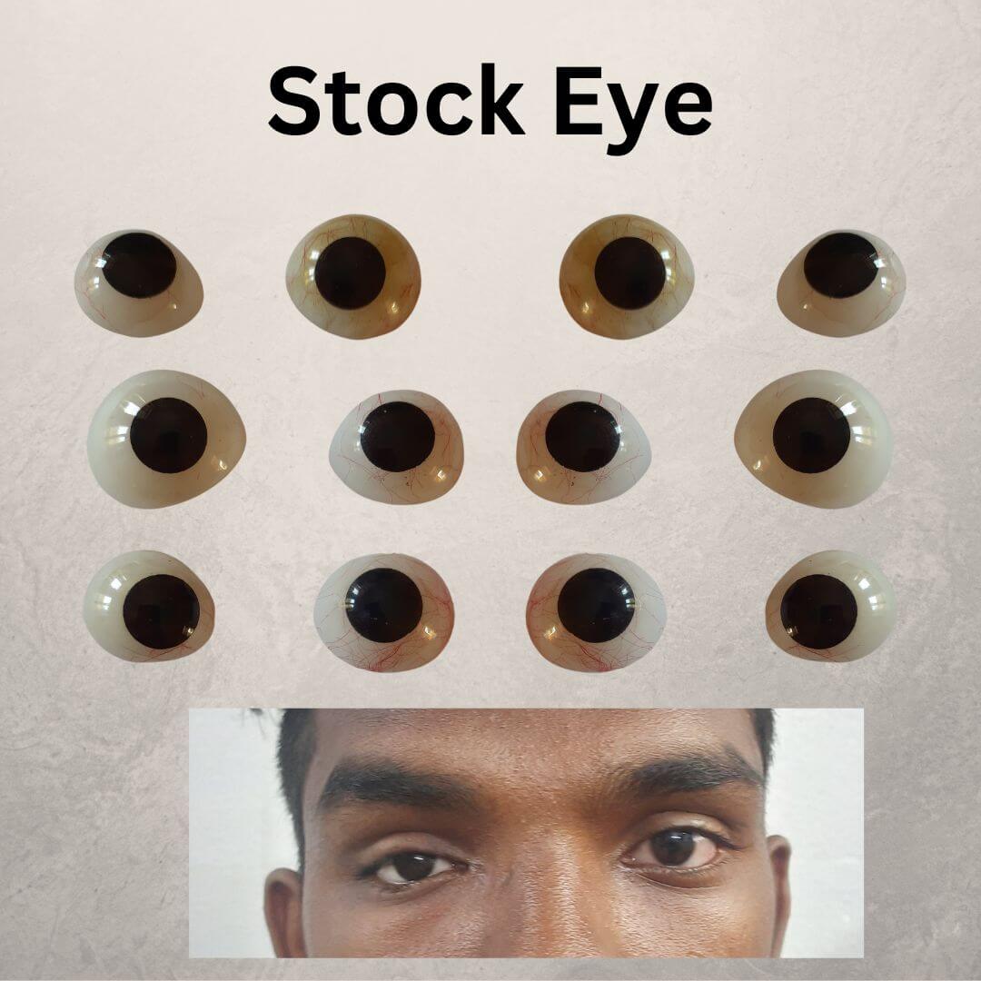 Artificial eye clinic in Hyderabad - Reform Vision